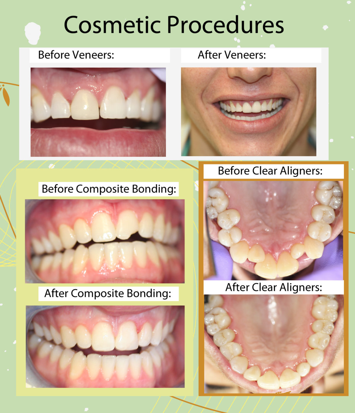 Cosmetic Procedures – McFarlane Dental