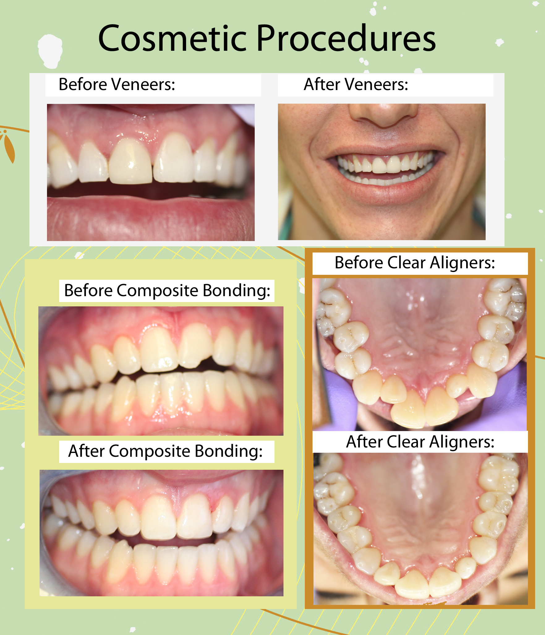 Cosmetic Procedures – McFarlane Dental